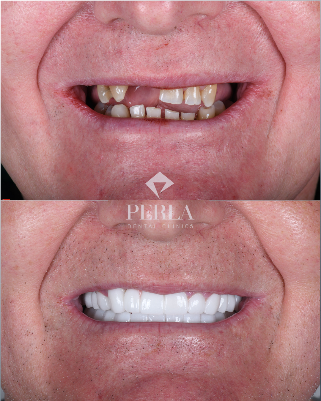 Smile Gallery Perla Dent