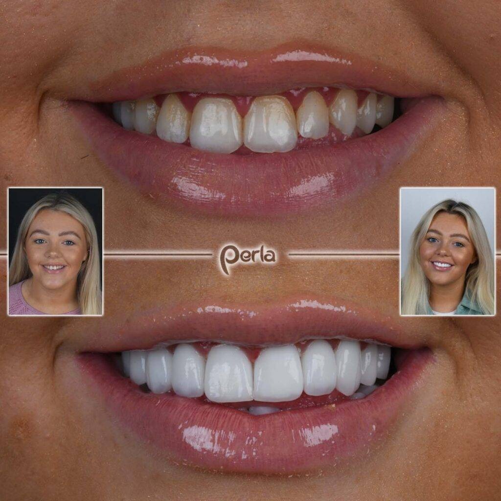 Antalya Perla Dent Dental Clinic | Private Dental Clinic | Dental ...